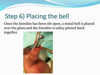 ***WARNING*** CIRCUMCISION HORROR. NSFW OR CHILDREN | PPTX