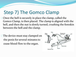 ***WARNING*** CIRCUMCISION HORROR. NSFW OR CHILDREN | PPTX