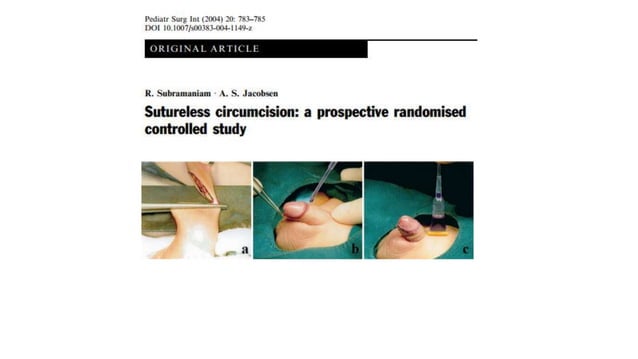 Circumcision | PPTX | Reproductive Health | Diseases and Conditions