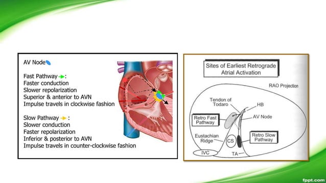 Circuits in avrt,avnrt i.tammi raju | PPTX