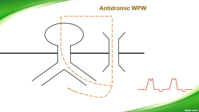 Circuits in avrt,avnrt i.tammi raju | PPTX