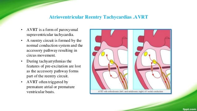 Circuits in avrt,avnrt i.tammi raju