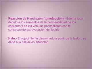 Circulaciones especiales | PPT