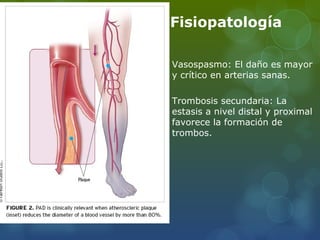 Circulacion venosa insuficiencia. | PPT