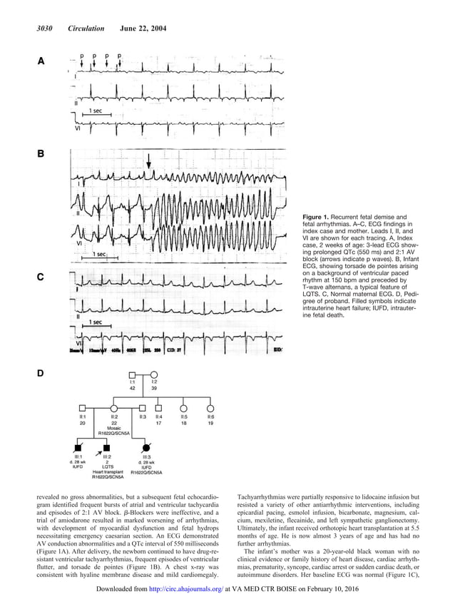 Recurrent Third Trimester Fetal Loss And Maternal Mosaicism For Long Qt Syndrome Pdf