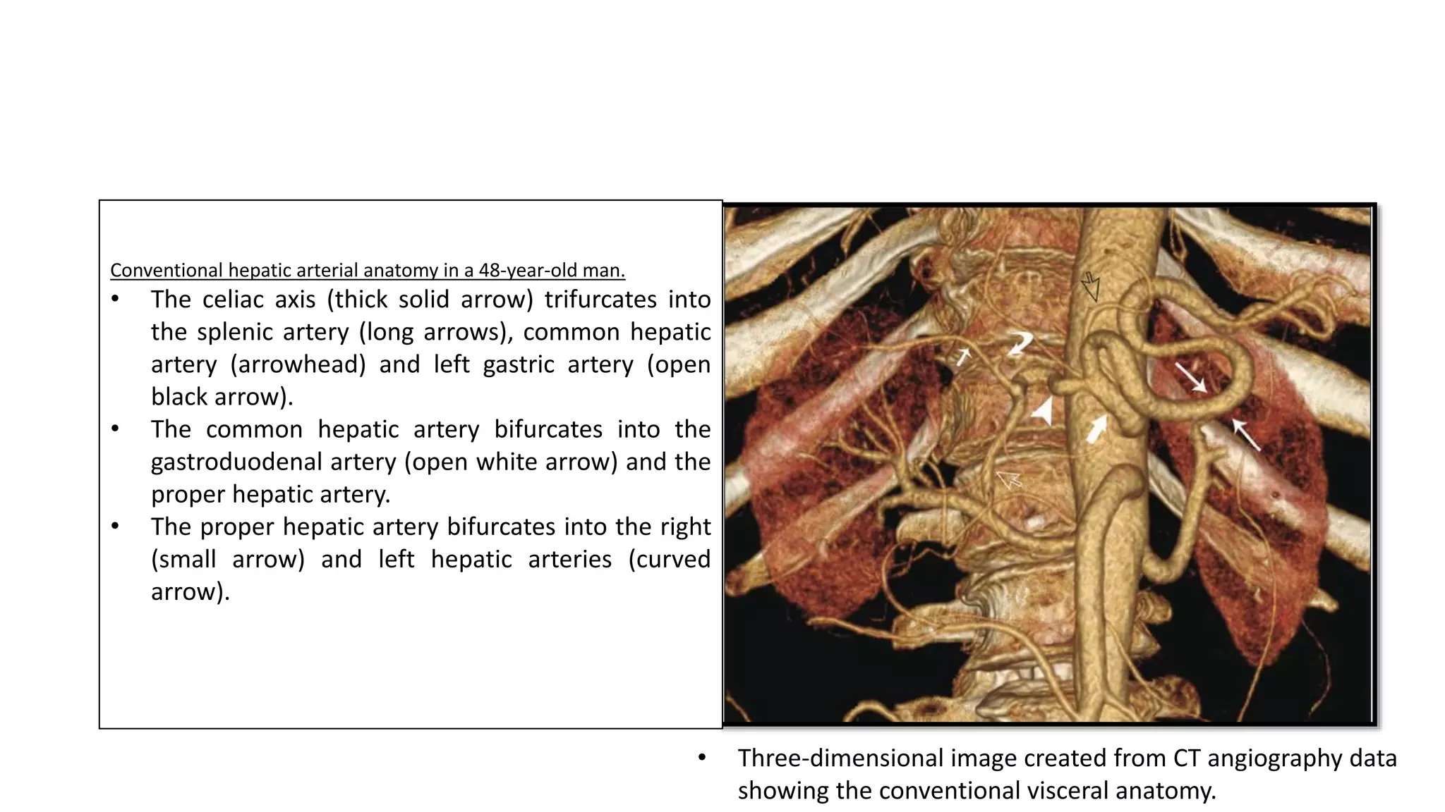 Circulation of liver & Portosystemic collaterals | PPTX