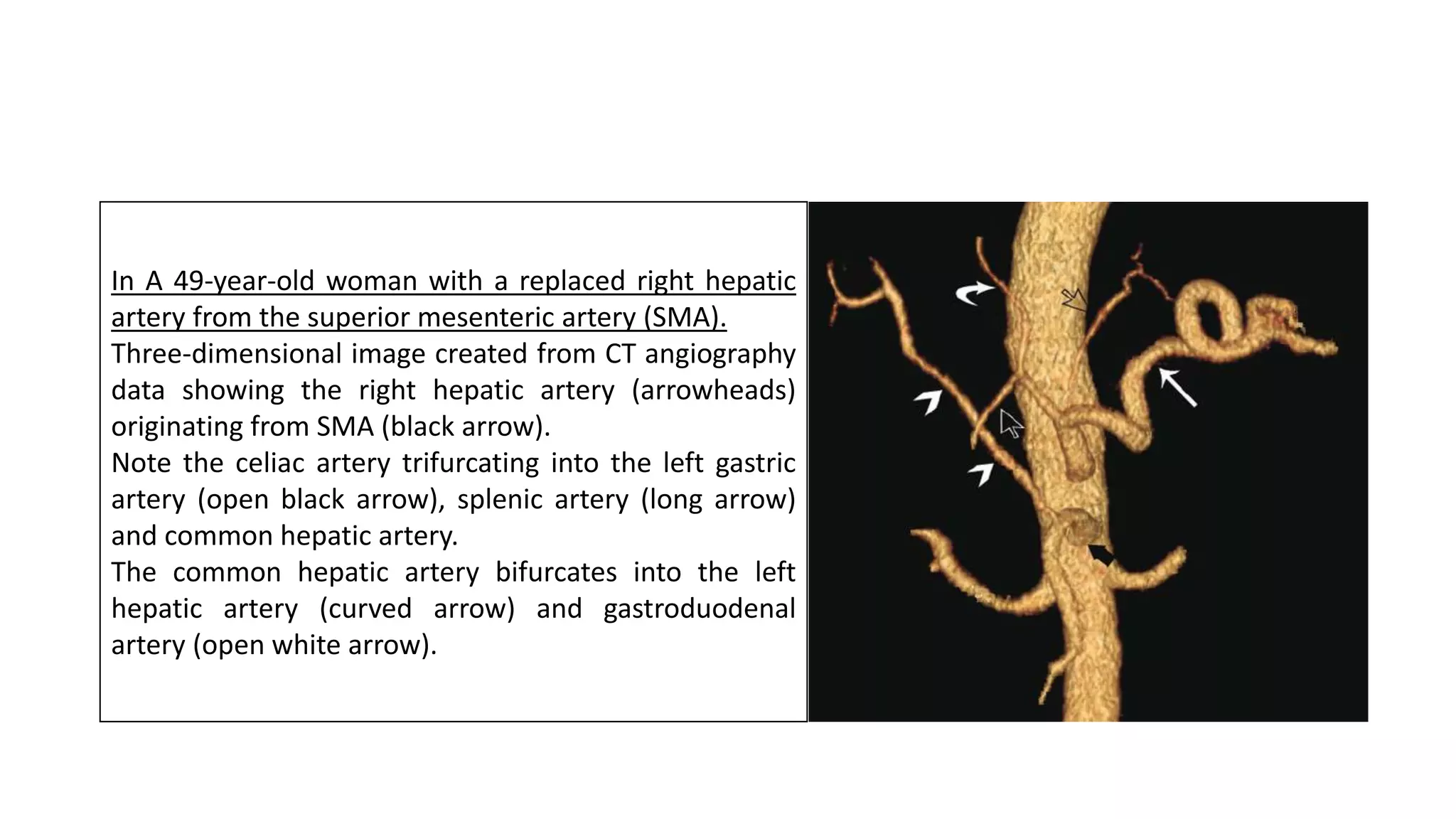 Circulation of liver & Portosystemic collaterals | PPTX