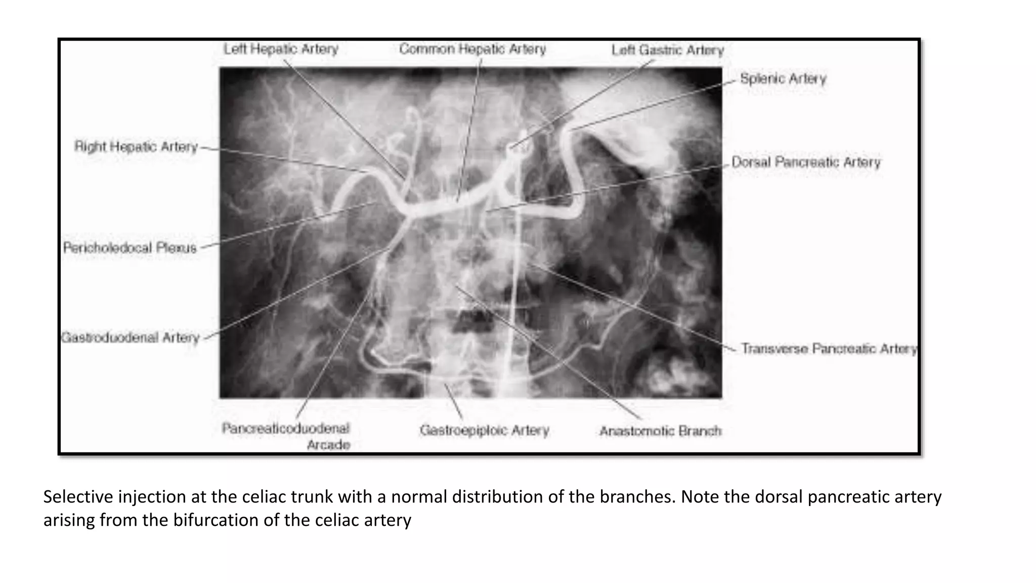 Circulation of liver & Portosystemic collaterals | PPTX