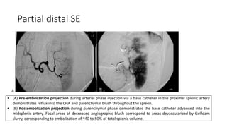 Circulation of liver & Portosystemic collaterals | PPTX