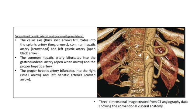 Circulation of liver & Portosystemic collaterals | PPTX | Blood ...