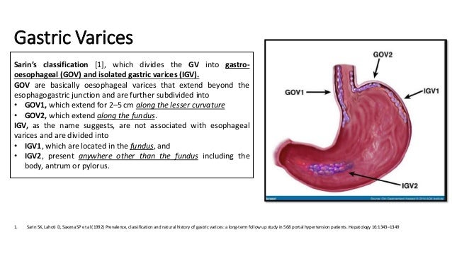 Circulation of liver & Portosystemic collaterals