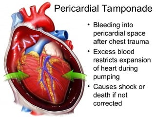 circulatory-system-for academics purposes | PPT