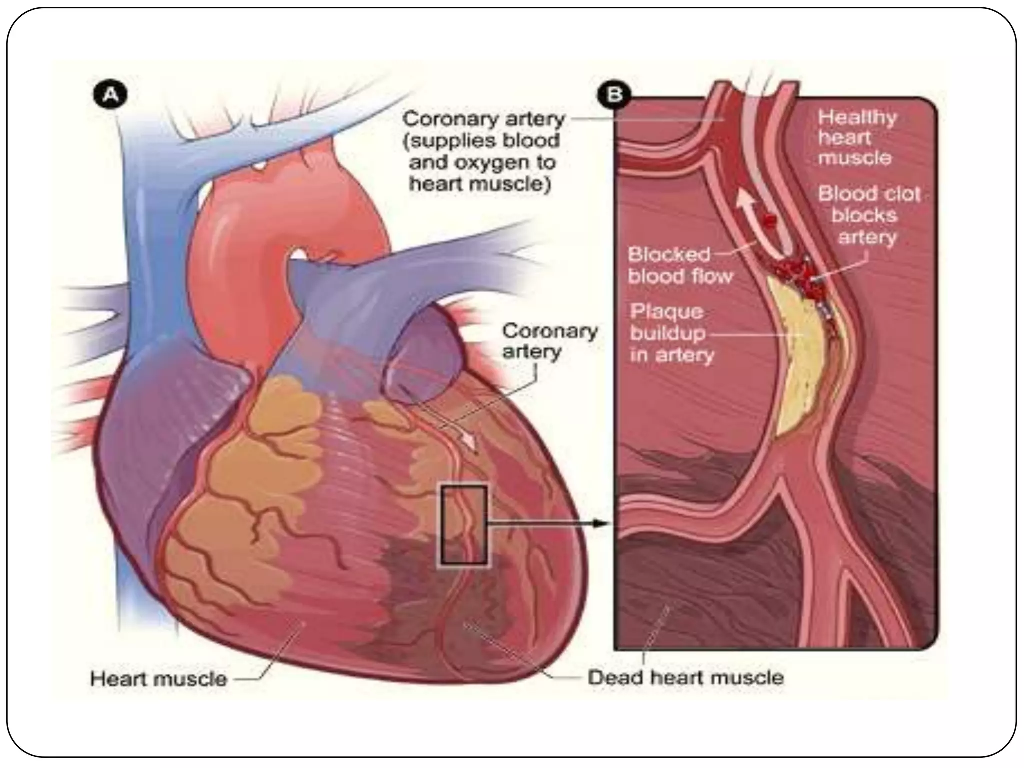 Circulatory diseases and disorders | PPTX