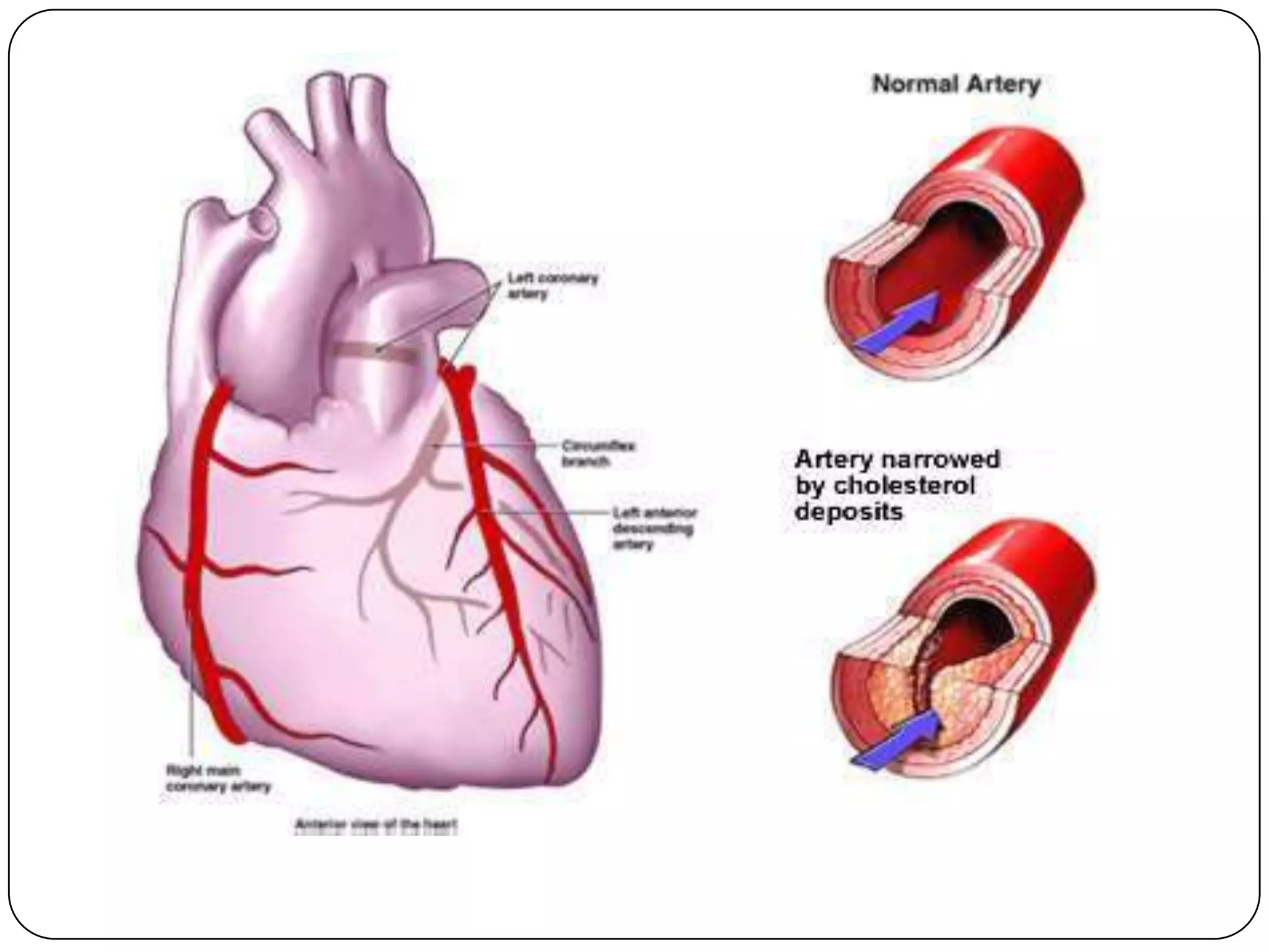 Circulatory diseases and disorders | PPTX