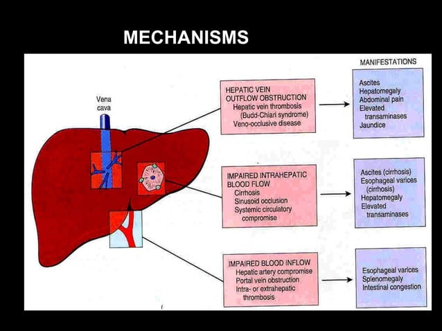 Circulatory disorders of liver | PPT