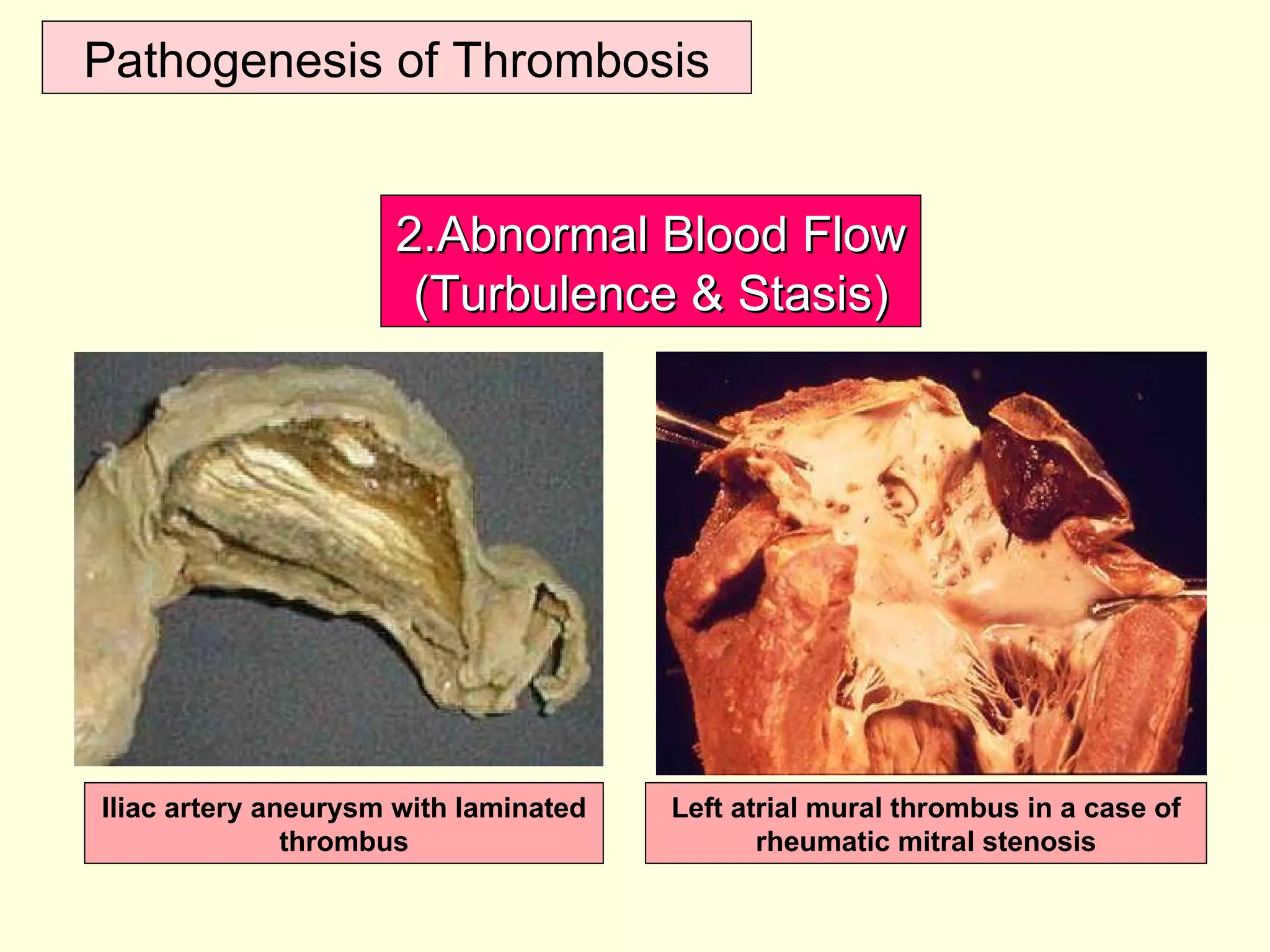 Circulatory disturbances | PPT