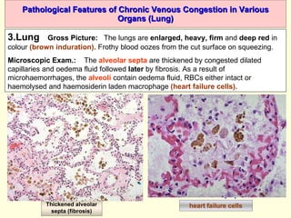 Circulatory disturbances | PPT