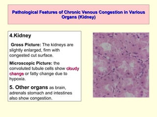 Circulatory disturbances | PPT