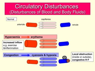 Circulatory disturbances | PPT