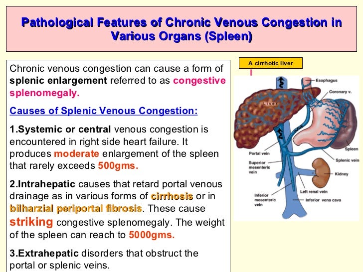 Circulatory disturbances