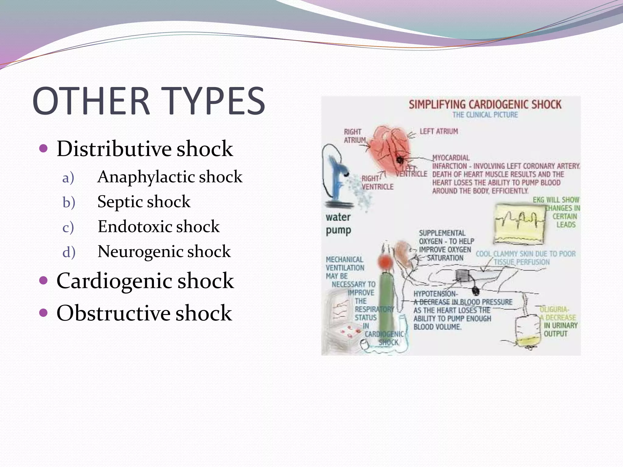 Circulatory shock | PPTX
