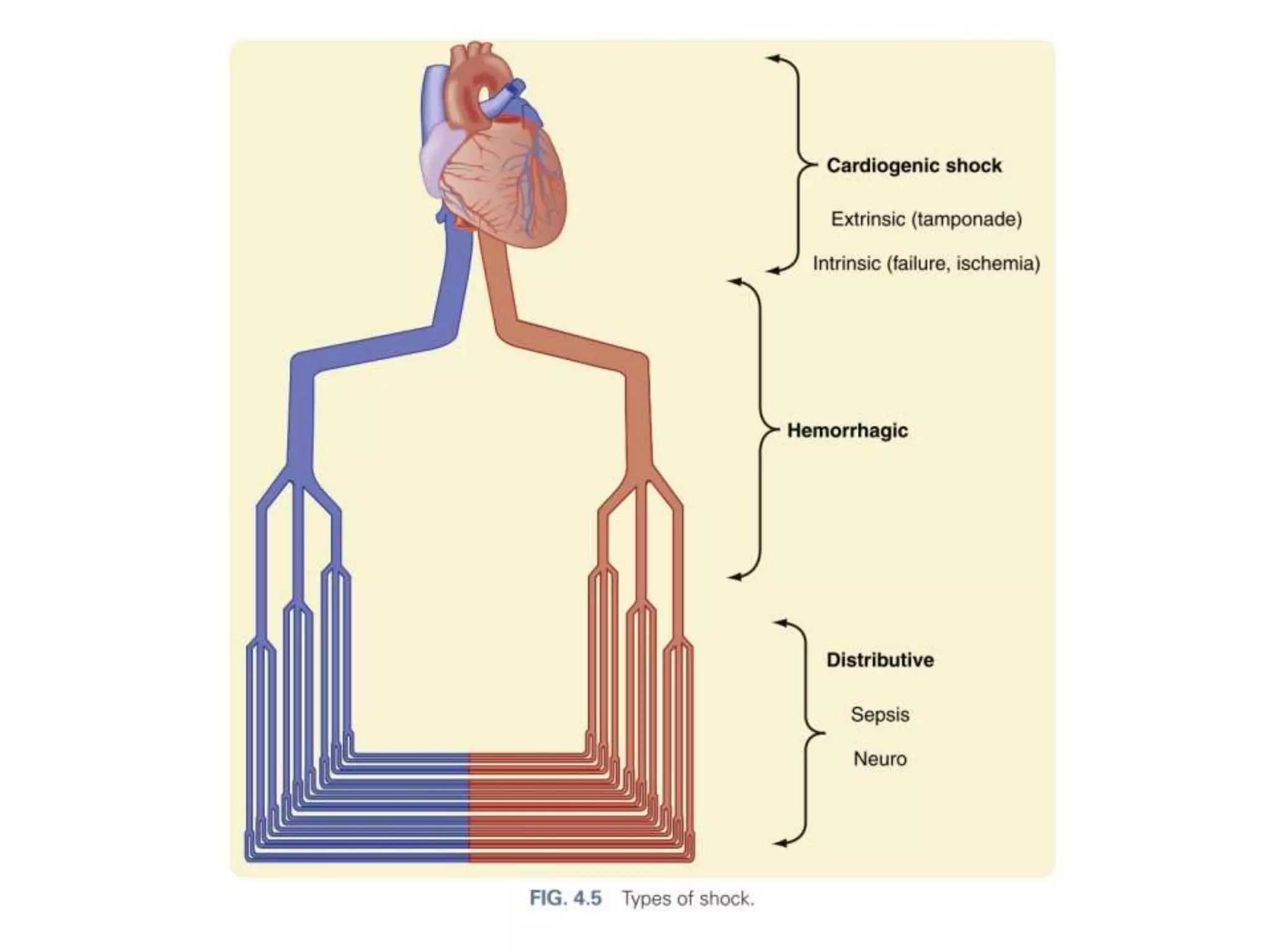 circulatory shock.pptx
