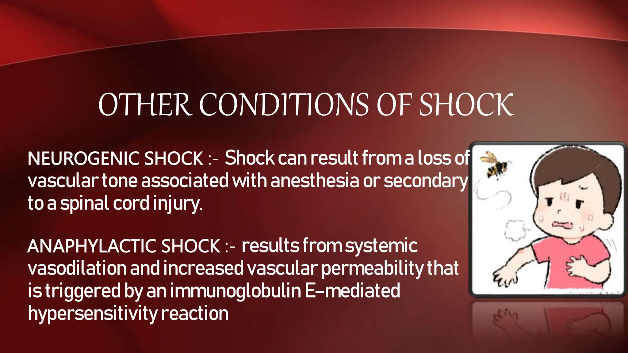Circulatory shock Cardiogenic Shock Hypovolemic Shock Sepsis, Septic ...