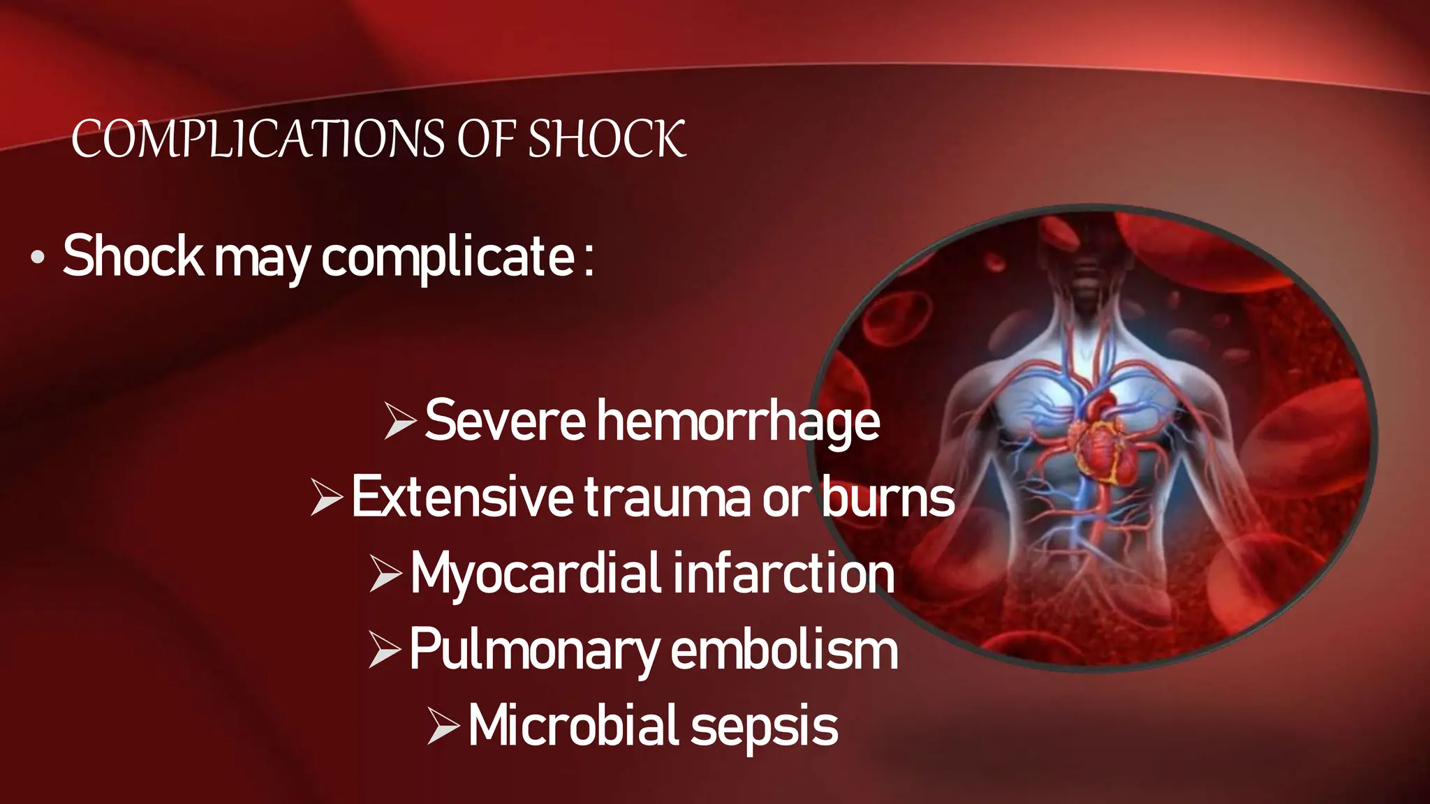 Circulatory shock Cardiogenic Shock Hypovolemic Shock Sepsis, Septic ...