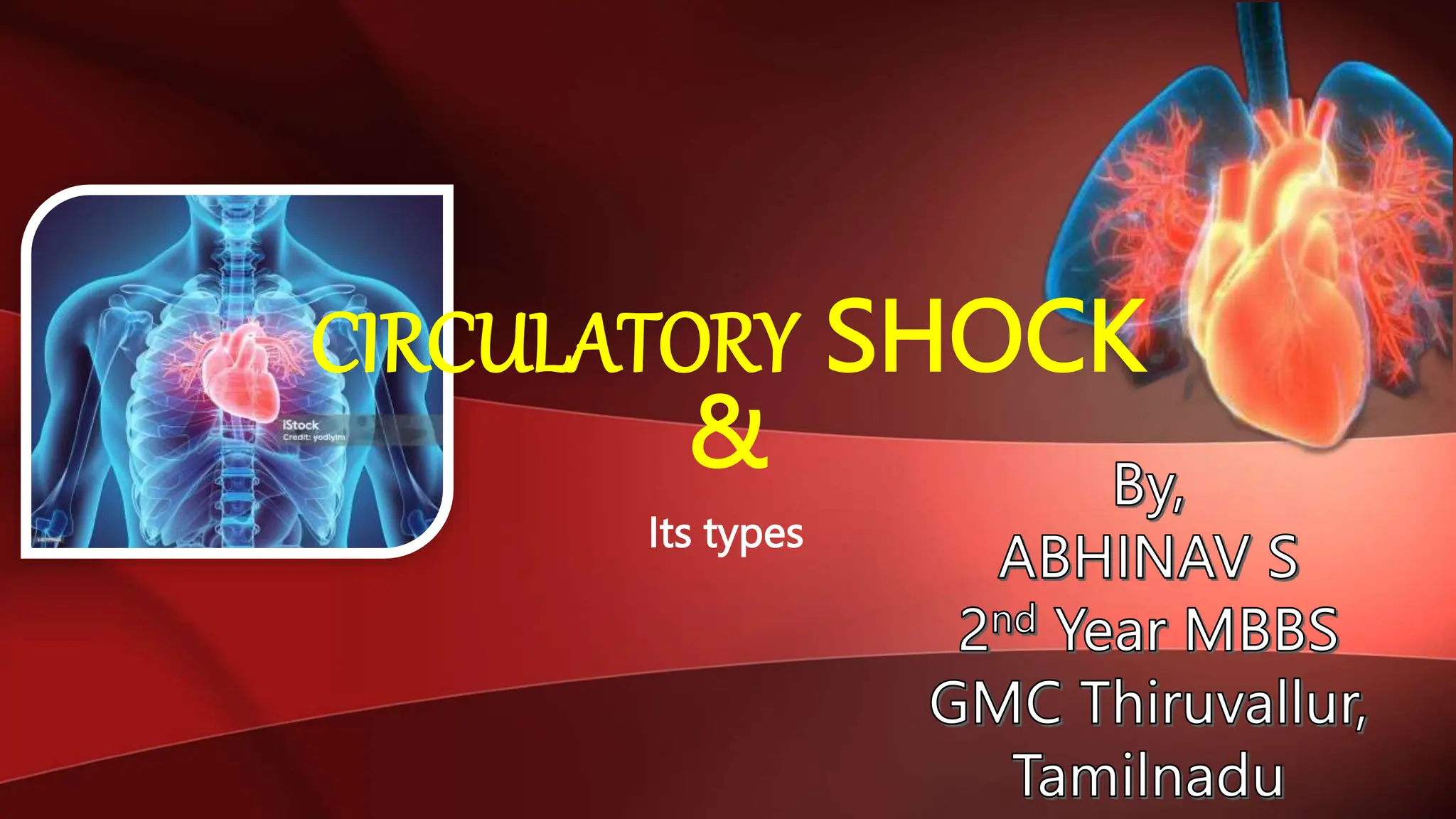 Circulatory Shock Cardiogenic Shock Hypovolemic Shock Sepsis Septic Shock And Sirs Ppt