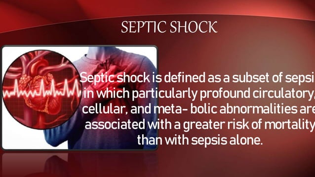 Circulatory shock Cardiogenic Shock Hypovolemic Shock Sepsis, Septic ...