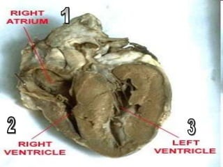 Human Anatomy Heart Quiz