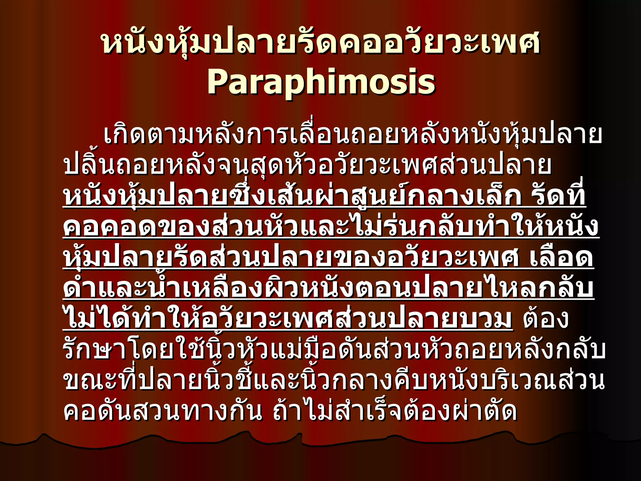 Circumcision Ppt
