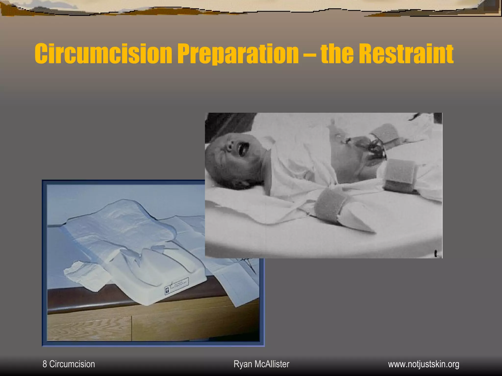 Circumcision | PPT