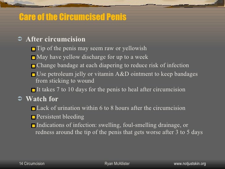 Circumcision