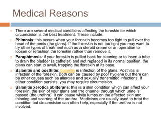 Circumcision | PPTX