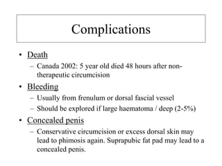 Circumcision.ppt
