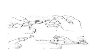 AN OVERVIEW OF CIRCUMCISION AND VARIOUS TYPES | PPTX