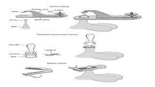 AN OVERVIEW OF CIRCUMCISION AND VARIOUS TYPES | PPTX