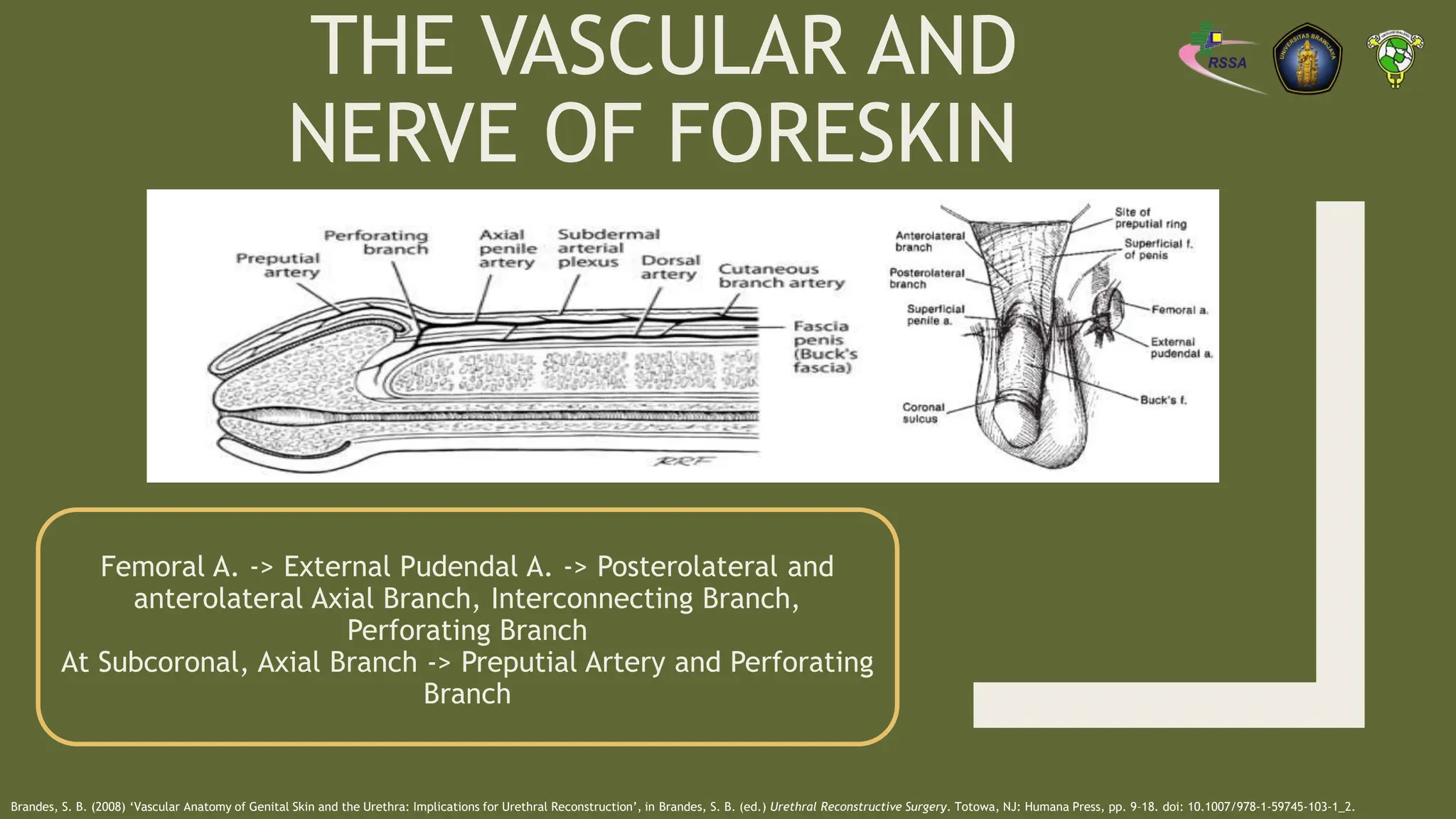 Circumcision Procedure in Hemophilia Patients Revision.pptx