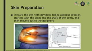 Circumcision Procedure in Hemophilia Patients Revision.pptx