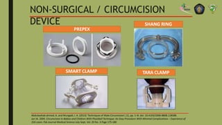 Circumcision Procedure in Hemophilia Patients Revision.pptx