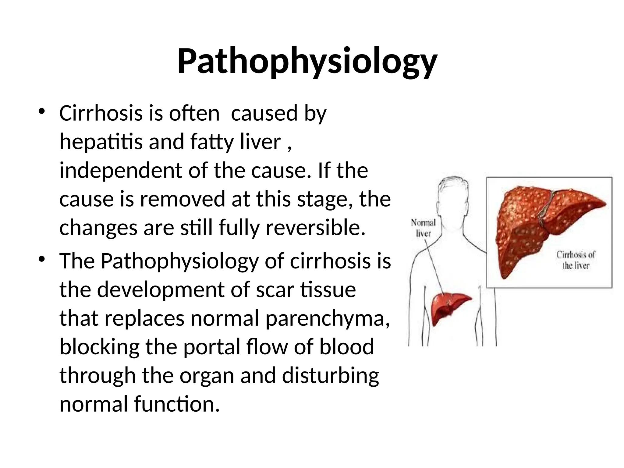 cirrhosis-161023040935 for nursing student.ppt.pptx