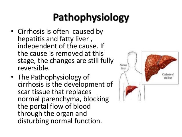 Liver Cirrhosis Pathophysiology
