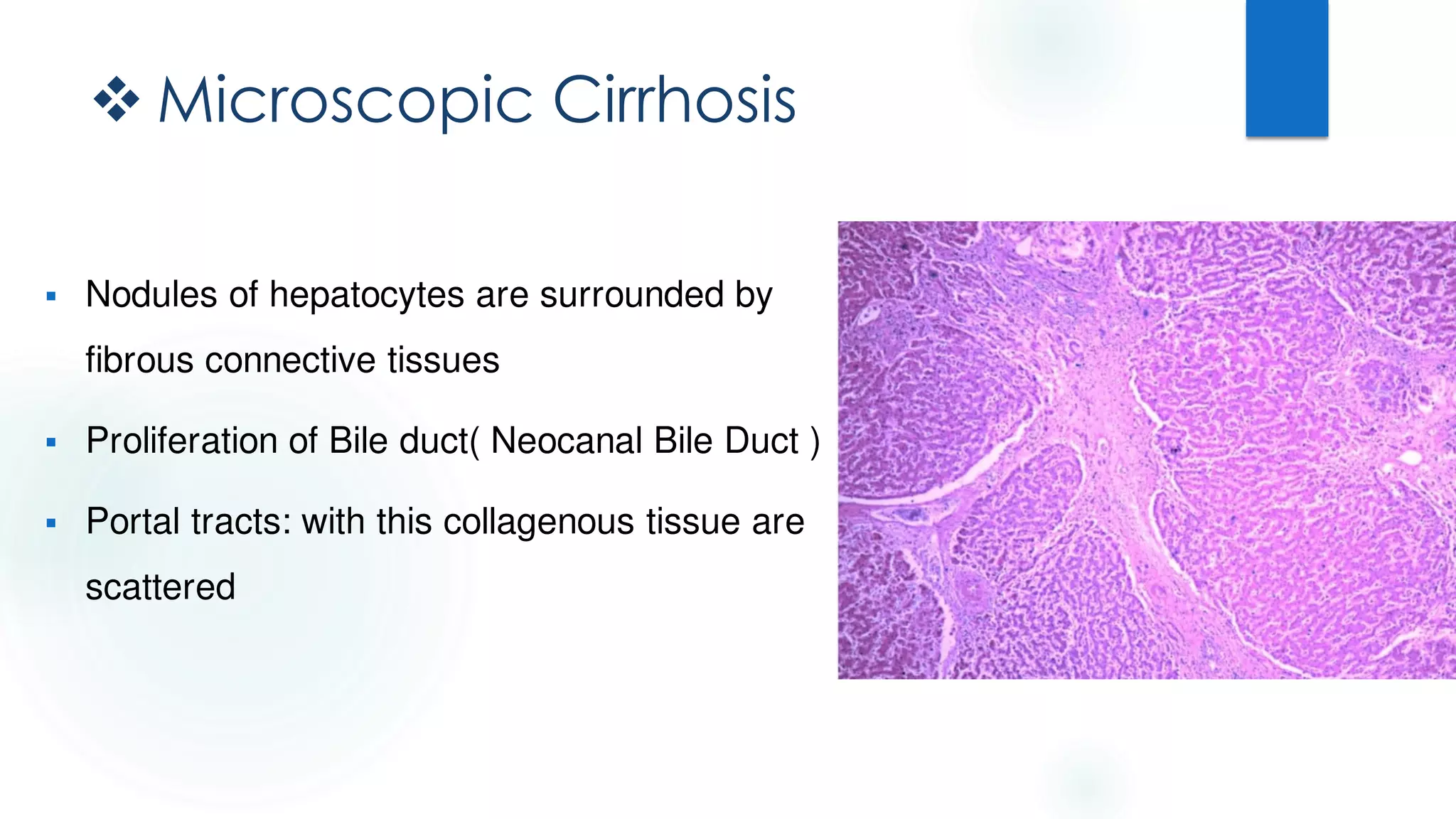 Cirrhosis Liver | PDF