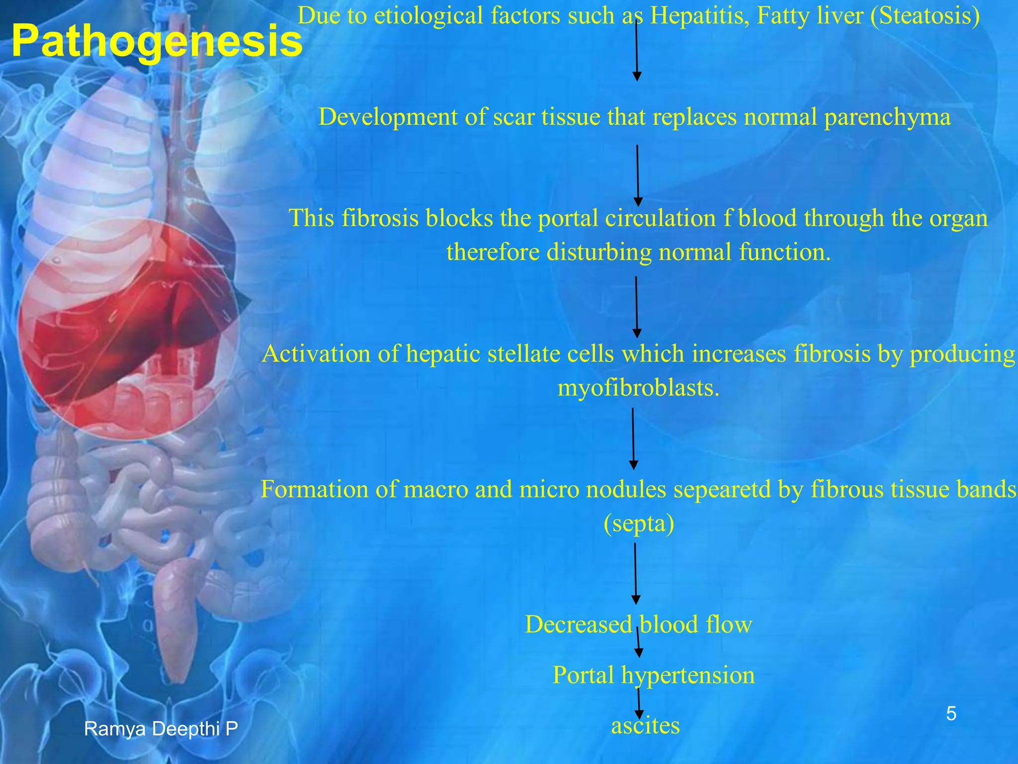 Cirrhosis of liver | PPTX