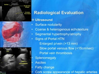 Cirrhosis of liver | PPTX