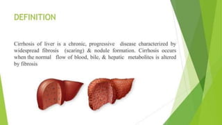 cirrhosis of liver.pptx