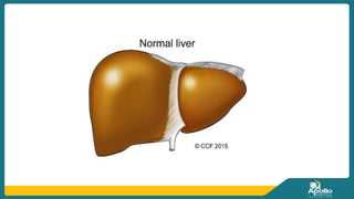 CIRRHOSIS OF LIVER Gastro intestinal system PPT.pptx