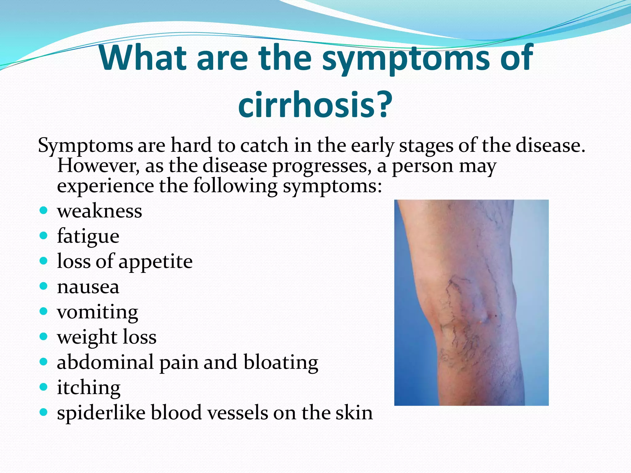 Cirrhosis of the liver (1) | PPT