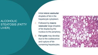 cirrhosis ppt-1.pptx